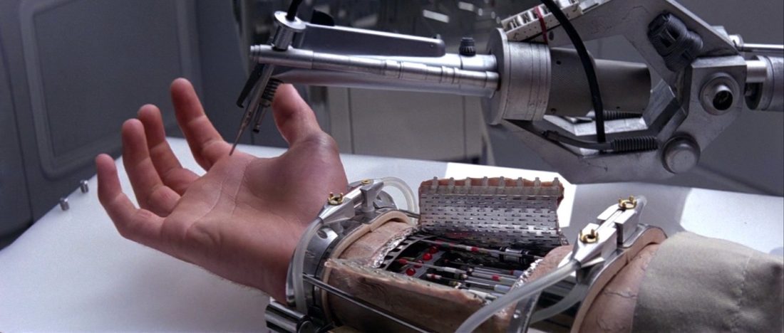 They Named a Prosthetic Arm After Luke Skywalker. And Now It Can ...